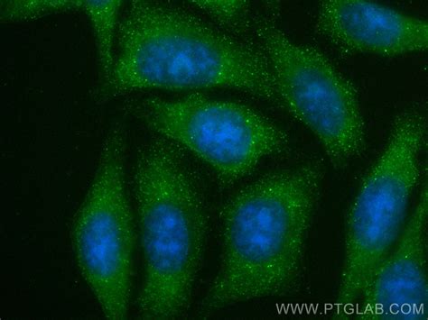 Mmp8 Antibody 82885 1 Rr Proteintech