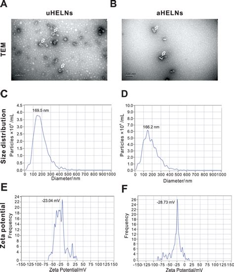 Characterization Of UHELNs And AHELNs Identified By A And B TEM C