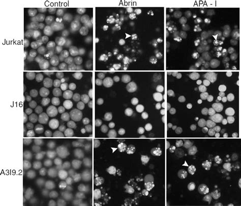 Staining Apoptotic Nuclei With Acridine Orange And Ethidium Bromide