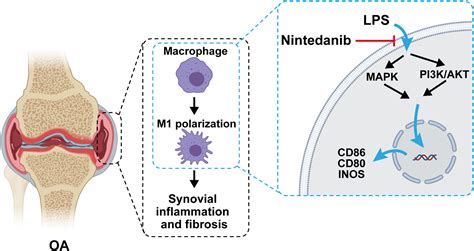 Nintedanib Ameliorates Osteoarthritis In Mice By Inhibiting Synovial