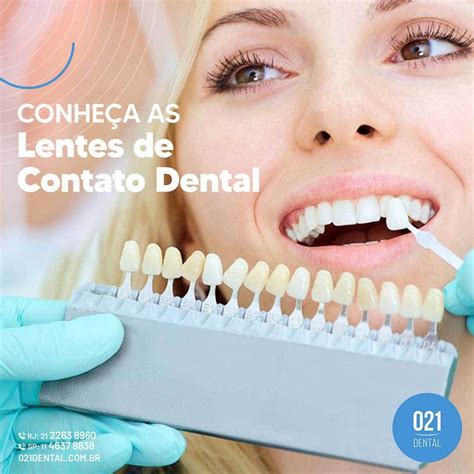 Lente De Contato Dental Artofit