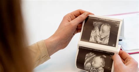 What Is Pgt A And When Is It Recommended Punta Mita