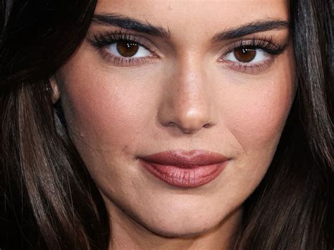 Kendall Jenner With Braces See Her Transformation And Stunning Results