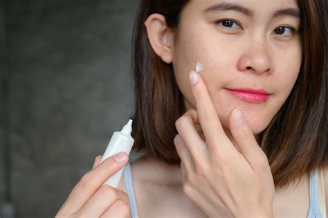 Manfaat Clindamycin Ternyata Bisa Sebagai Obat Jerawat Honestdocs