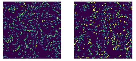 how to interpret stardist matching results usage and issues image sc