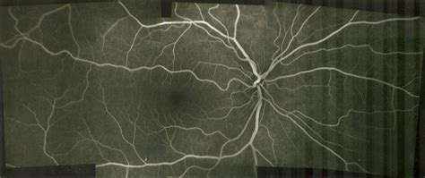 Sex Oculus