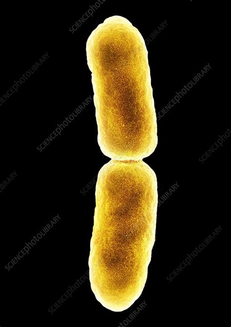 E Coli Bacterium Dividing Sem Stock Image C048 1466 Science Photo Library