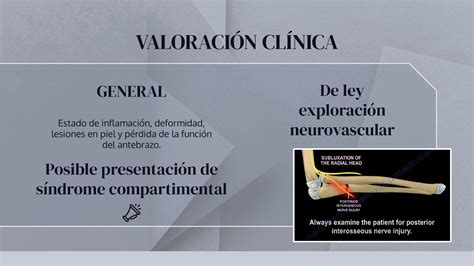 Monteggia Y Galeazzi Monteggia Fracture Practice Essentials Anatomy