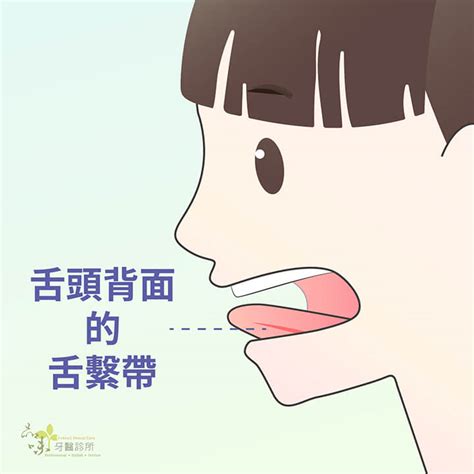 孩子咬字不清，舌繫帶過短該剪嗎？ 新竹品味牙醫 牙醫師心底話