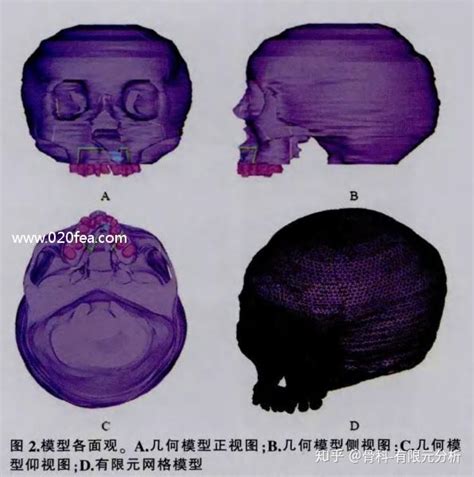 唇腭裂上颌前段牵张成骨的三维有限元分析 知乎