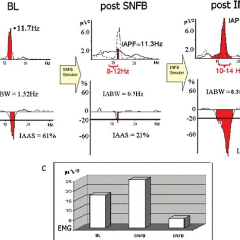 The Individual Alpha Peak Frequency Iapf Individual Alpha Band Width Download Scientific