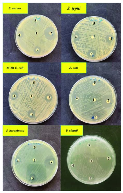 1 Sterile Virgin Disk As Negative Control 2 Gentamicin As The