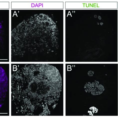Knockdown Of Rps3 Induces Apoptosis In The Testes Ab The Tunel