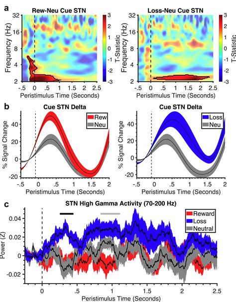 Subthalamic Oscillatory Activity Of Reward And Loss Processing Using The Monetary Incentive