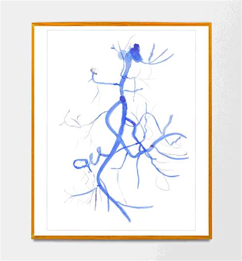 Radiology Art Dsa Internal Iliac Artery Uterine Artery Medpapers