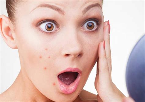 How To Get Clear Skin Fast Naturally