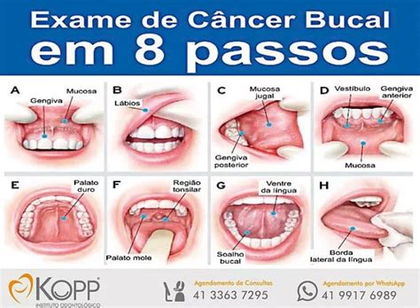 Campanha De Prevenção Do Câncer Bucal Instituto Kopp Odontologia