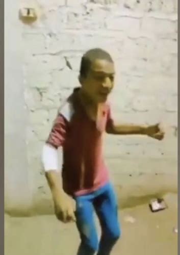 Science Autoimmune Disorders Flashcards Quizlet