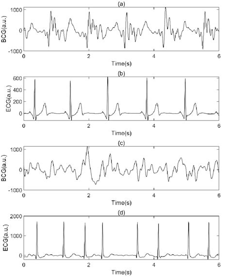 Examples Of Bcg Signal And Synchronized Ecg Au Arbitrary Units