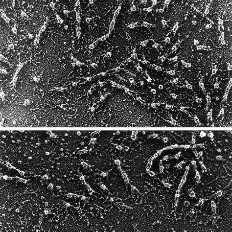 Low Magnification View Of Ciliary Zonule Microfibrils Cz And Basement