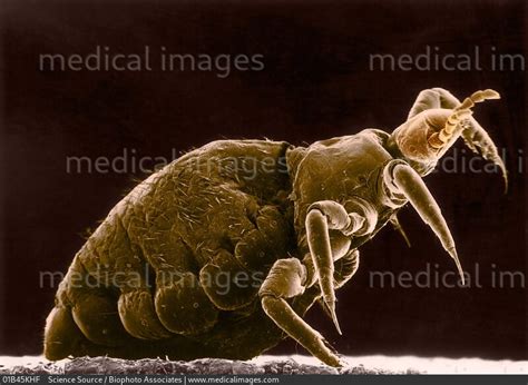 Stock Image Bz6638 01b45khf Science Source Search Medical
