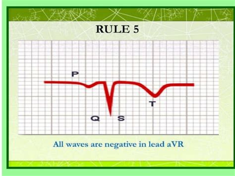 Ecg Basic Rules Ppt