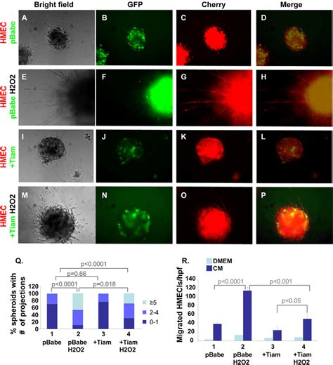 Upregulation Of Tiam1 In Senescent Rmf Cells Inhibits The Invasion And