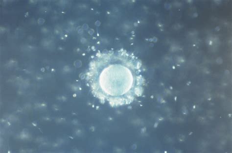 Microplastics Aangetroffen In Menselijke Voortplantingsvloeistoffen