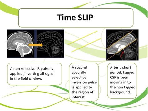 Csf Flow Study Pptx