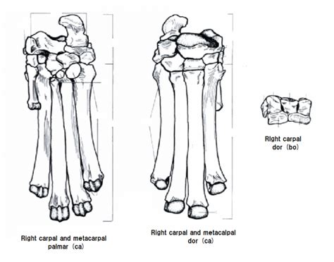 Right Carpal And Metacarpal Bones Quiz