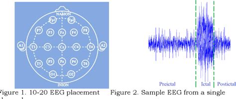 Figure 4 From Epileptic Seizure Detection Using Deep Learning Through Min Max Scaler