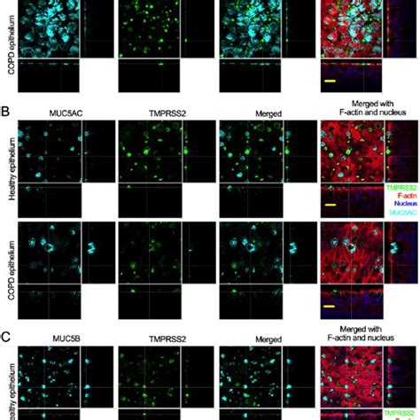 Ace2 Is Expressed At Higher Levels In Goblet Cells The Airway