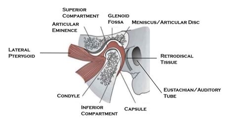 Temporomandibular Joint Tmj Dislocation