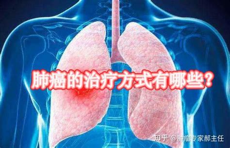 肺癌的治疗方法有哪些？ 知乎