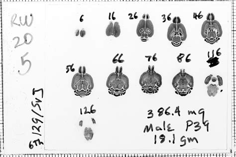 Index Of Whole Slides