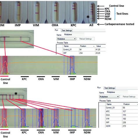 Multiplex Lateral Flow Immunochromatographic Assay For The Detection Of Download Scientific