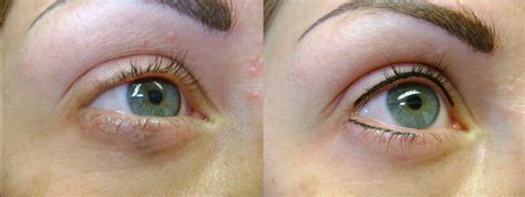 Permanent Eyeliner Before And After Pictures