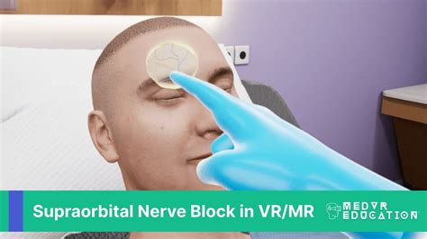 Supraorbital Nerve Block In Vr Mr Youtube