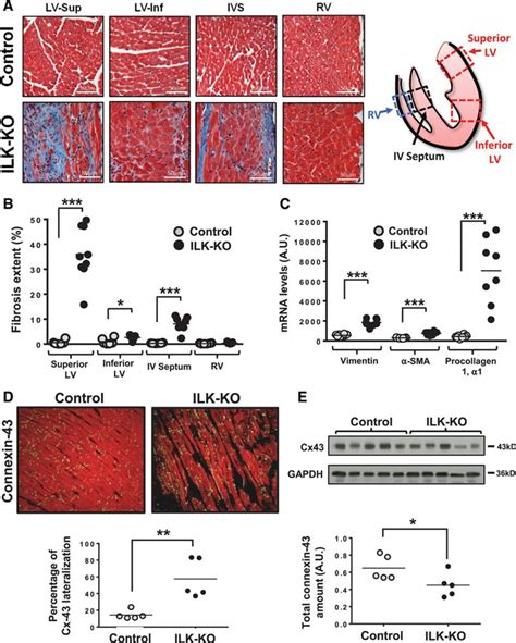 Loss Of Cardiomyocyte Integrin Linked Kinase Produces An Arrhythmogenic Cardiomyopathy In Mice