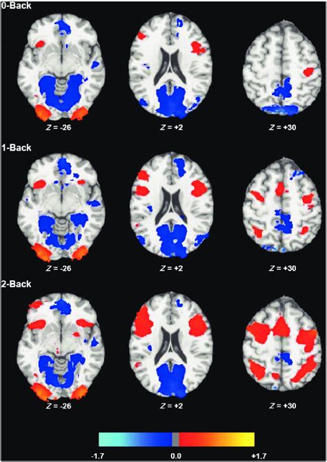 Statistical Parametric Maps For The Bold Percent Signal Changes For