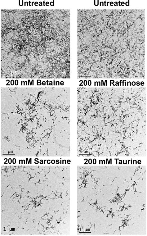 Transmission Electron Microscopy TEM Images Of The Preformed Amyloid