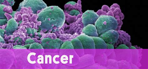 Cancer Treatment Modalities Lakeland Fl Natural Medicine Center