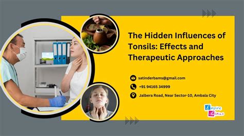 Tonsils Types Causes Effects And Ayurvedic Treatments