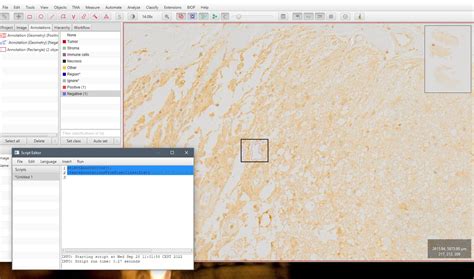 Classification For A Single Annotation Works With Run But Not With Run For Project Usage