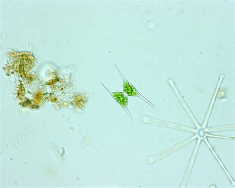 Staurodesmus Triangularis · Inaturalist