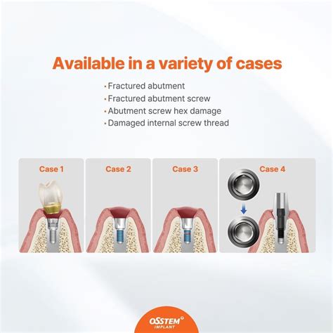 Osstem Thailand Esr Kit Screw Removal Kit