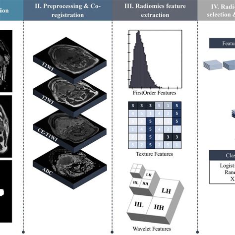 Flowchart Of The Radiomic Machine Learning Classifier Download