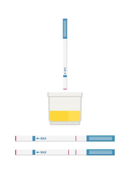 Best Urine Sample Illustrations Royalty Free Vector Graphics And Clip