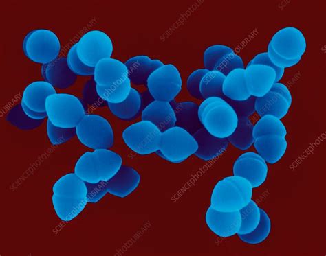 Enterococcus Faecium Sem Stock Image C032 2607 Science Photo Library