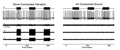 Response Of An Irregular Otolith Neuron During Stimulation By Bone Download Scientific Diagram